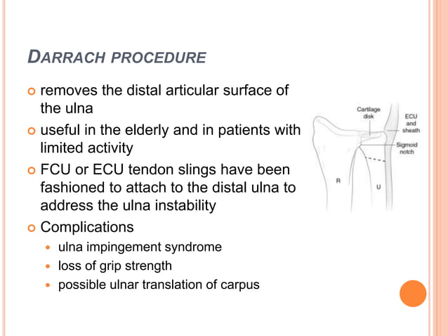 Distal radioulnar joint injuries | PPTX