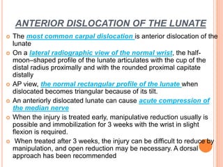 Distal radioulnar joint injuries | PPTX