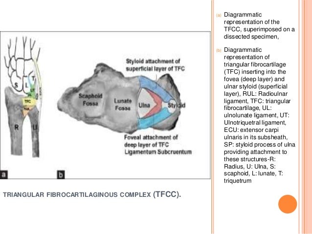 Distal radioulnar joint injuries( DRUJ) and carpal instability