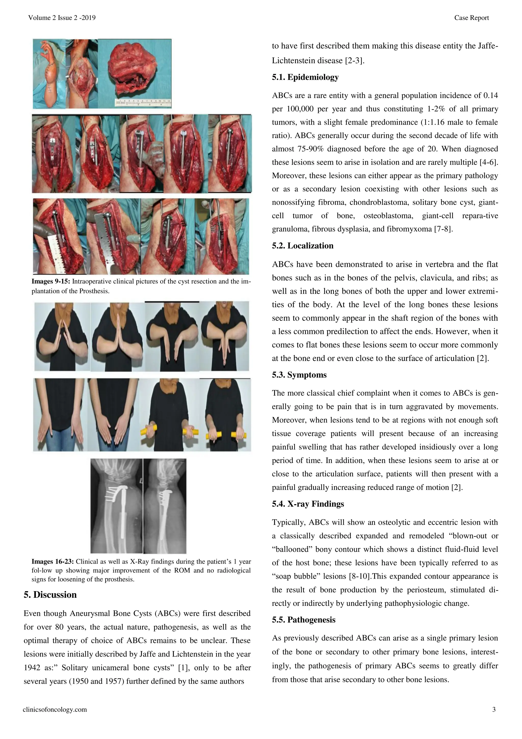 Distal_Radioulnar_Joint_Replacement_with.pdf