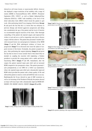Distal_Radioulnar_Joint_Replacement_with.pdf