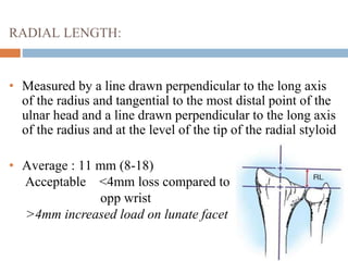 Distal radius. | PPTX