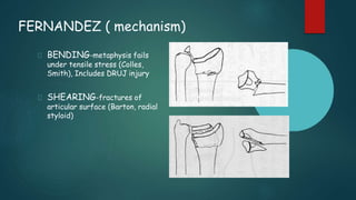 Distal Radius.Fractures | PPTX