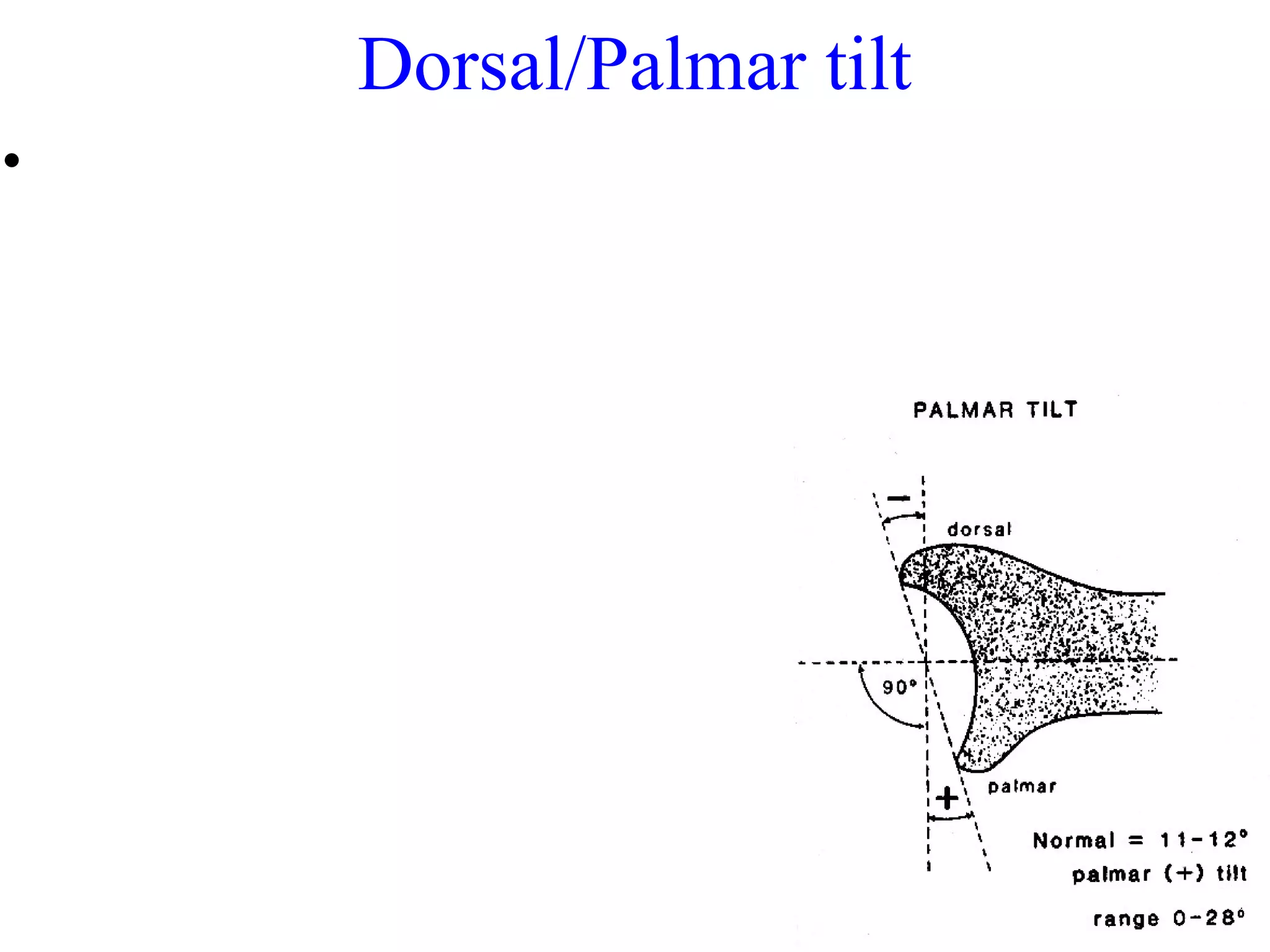 Distal radius fracture | PPT