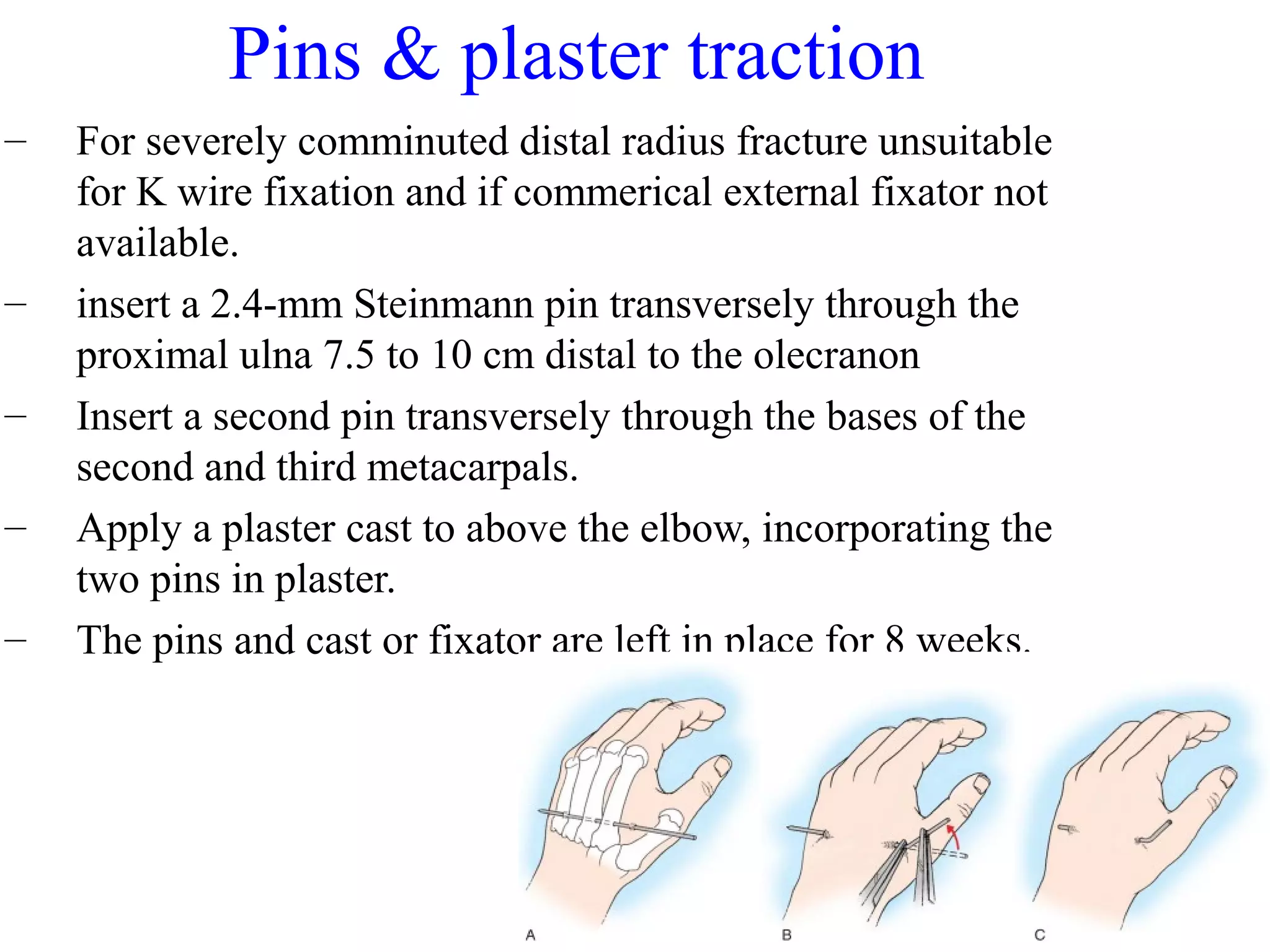 Distal radius fracture | PPT