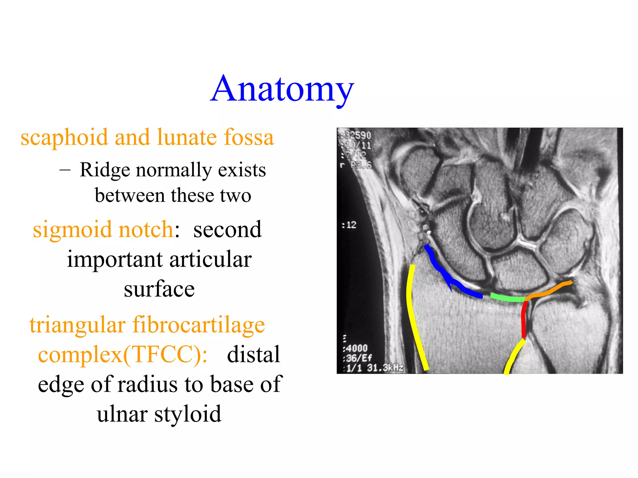 Distal radius fracture | PPT