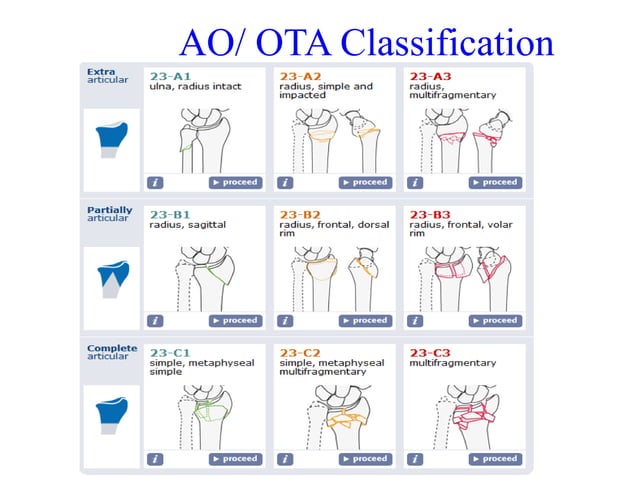 Distal radius fracture