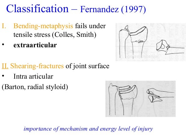 Distal Radius Fracture