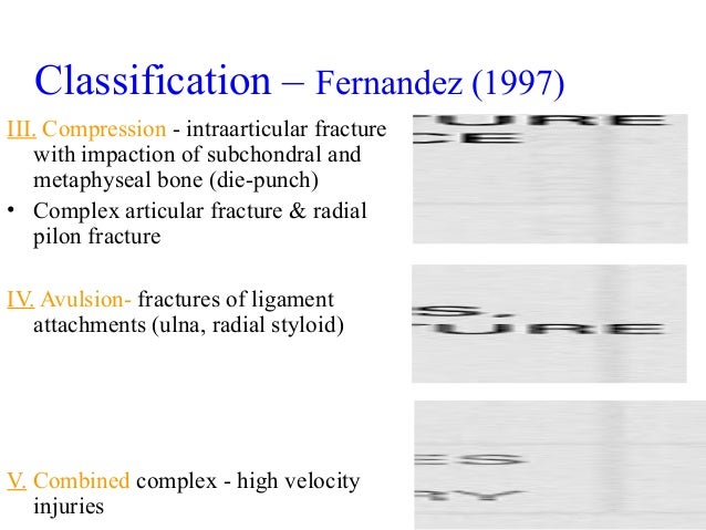Distal radius fracture