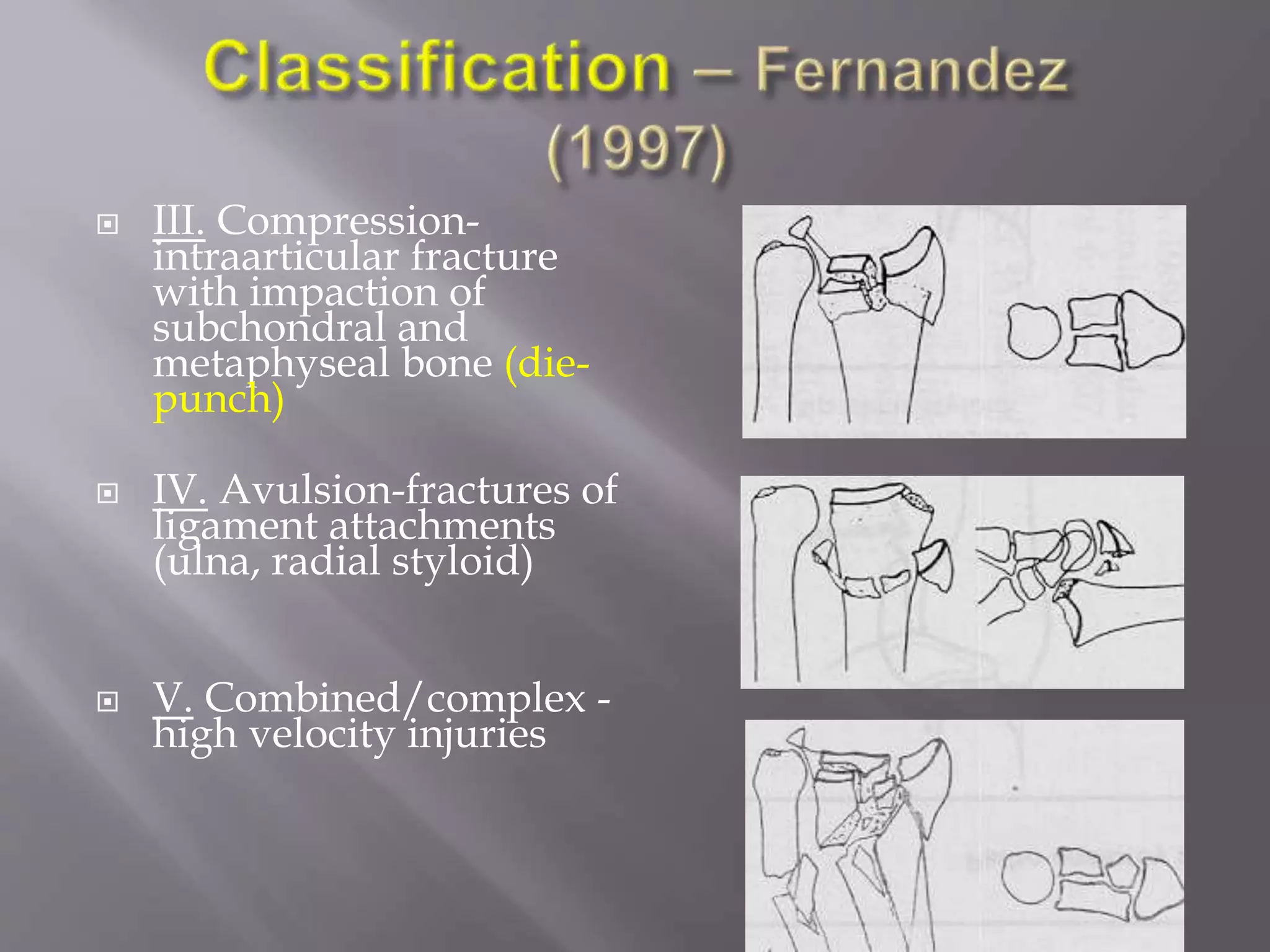 Distal radius fracture | PPTX