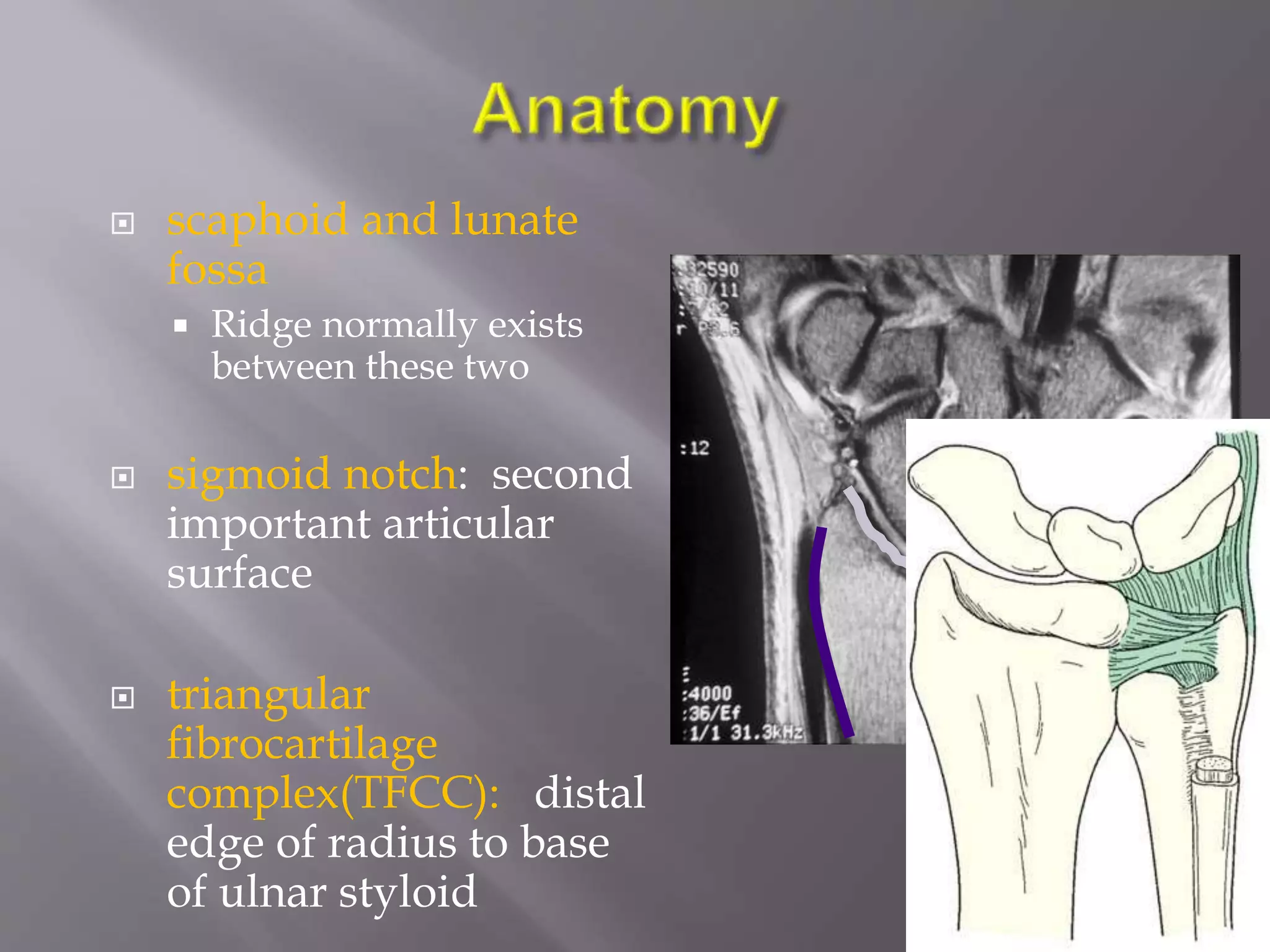 Distal radius fracture | PPTX