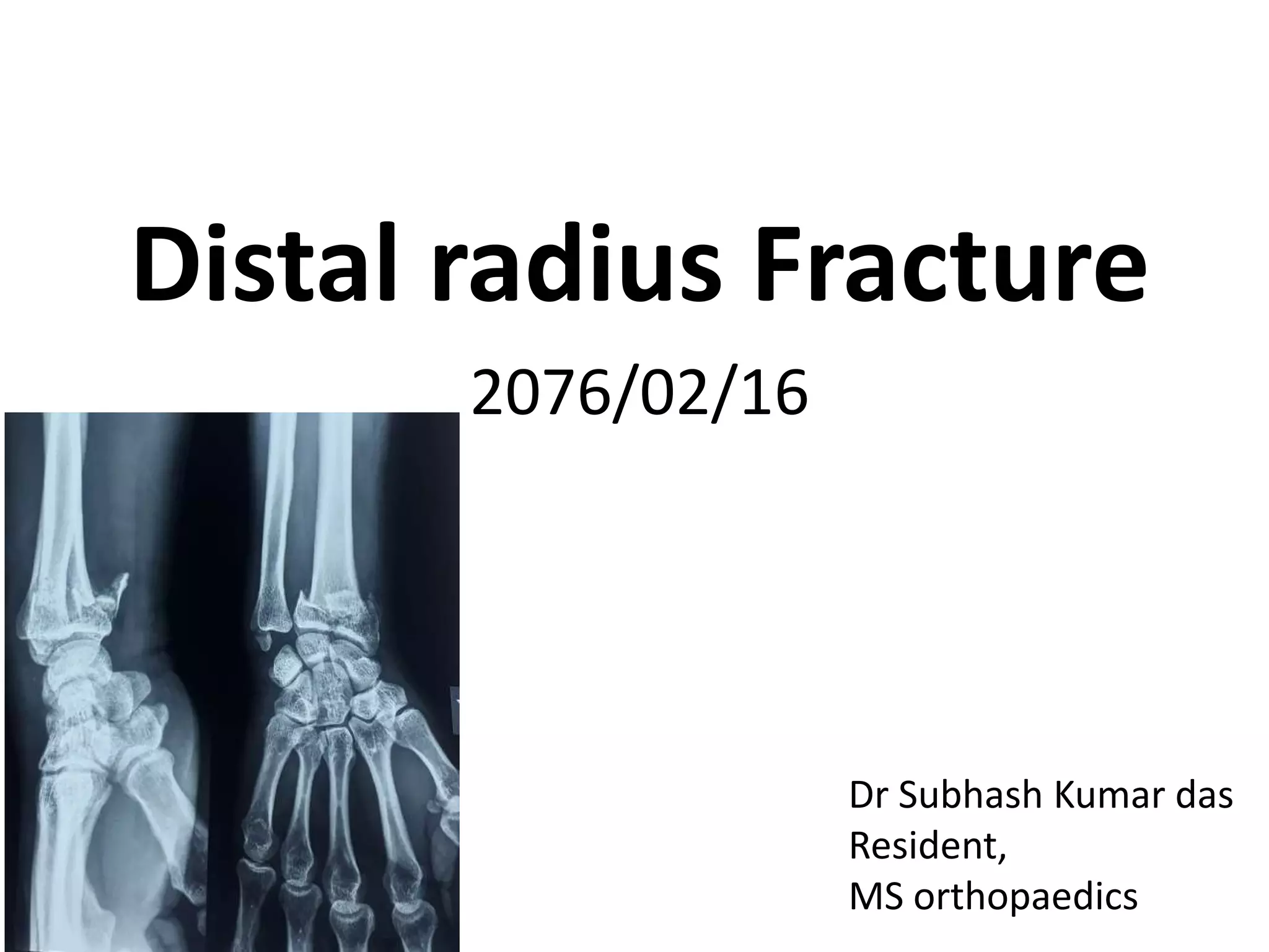 Distal radius fracture | PPTX
