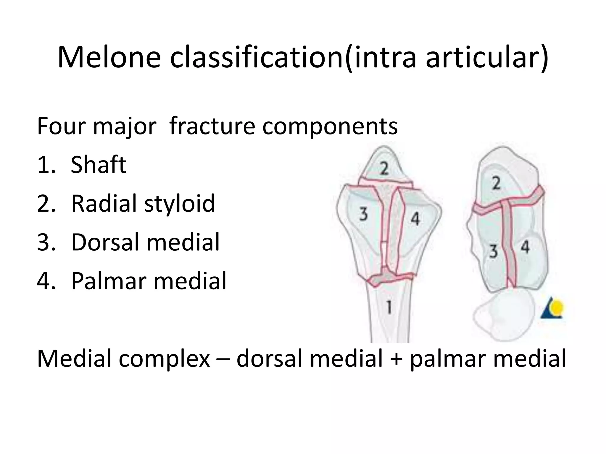 Distal radius fracture | PPTX