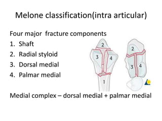 Distal radius fracture | PPTX | Death, Injury, or Military Conflict ...