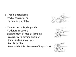 Distal radius fracture | PPTX
