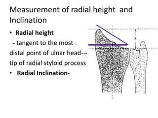 Distal radius fracture | PPTX