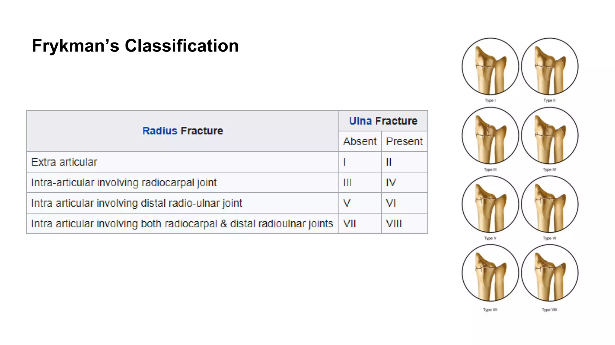 Distal radius fracture | PPTX