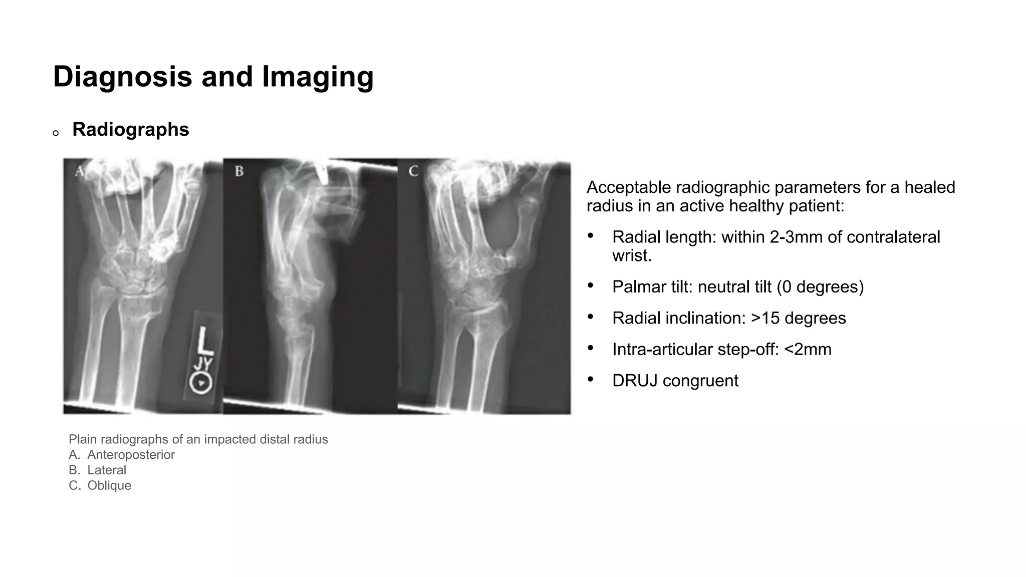 Distal radius fracture | PPTX