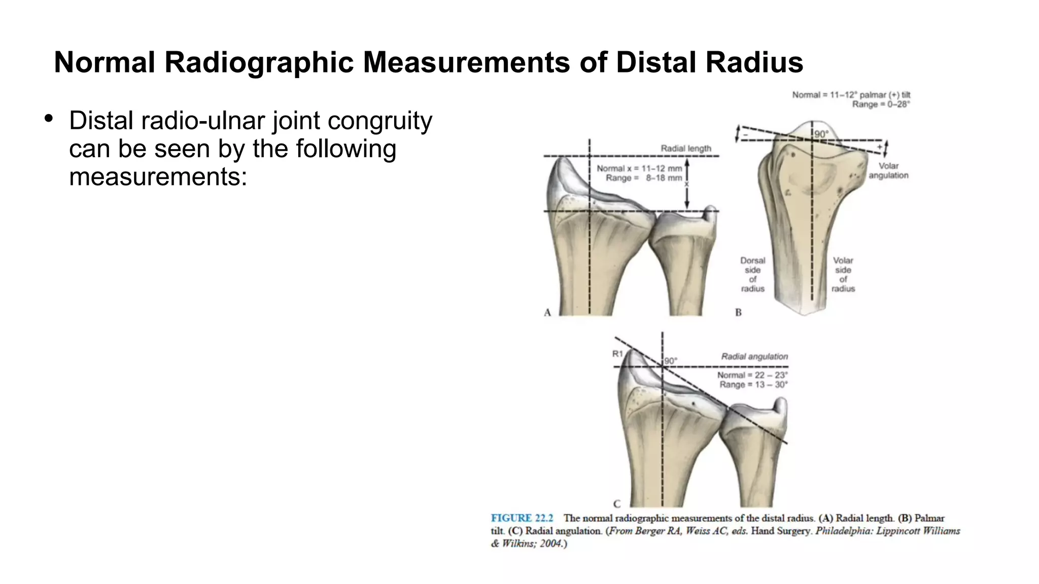 Distal radius fracture | PPTX