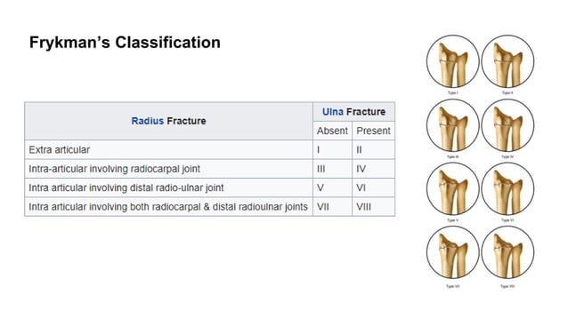Distal radius fracture | PPTX