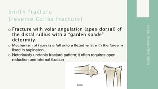 DISTAL RADIUS FRACTURE.pptx