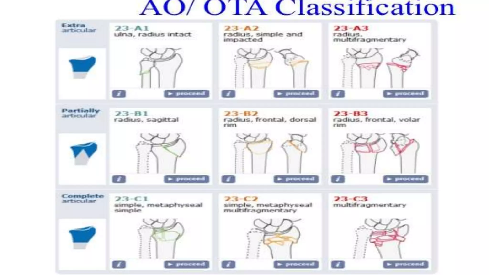 Distal radius fracture in adults | PPTX