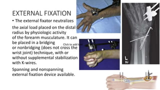 Distal radius fracture in adults | PPTX | First Aid | Injuries