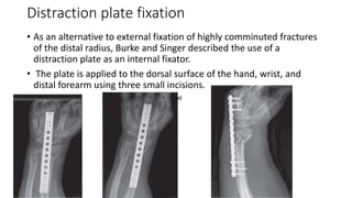 Distal radius fracture in adults | PPTX | First Aid | Injuries
