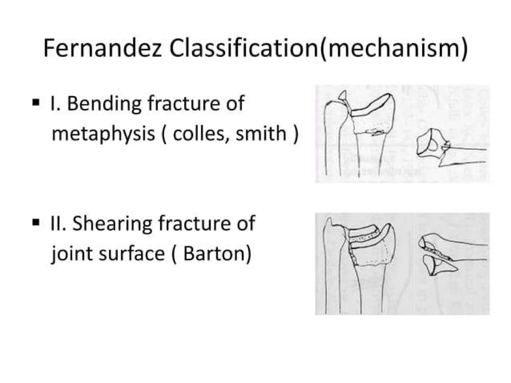 Distal Radius Fracture Case Presentation Pptx