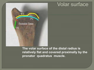 Distal radius fracture fixed angle volar plate | PPT