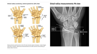 Distal radius fractures by recent last.pptx