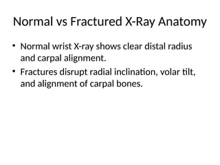 Distal_Radius_Fractures_With_Frykman.pptx