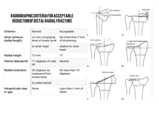 Distal_Radius_Fractures_With_Frykman.pptx