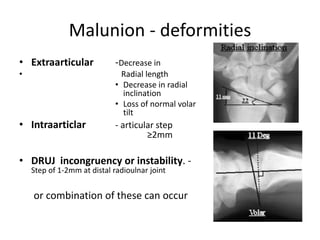 Distal radius malunion , correction | PPT