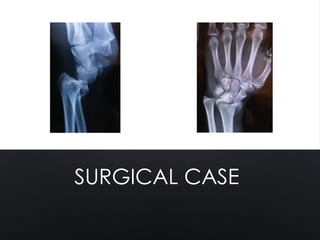Distal Radius fractures, treatment, comp | PPT