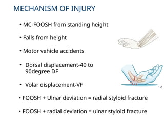 distal radius fractures power point.pptx
