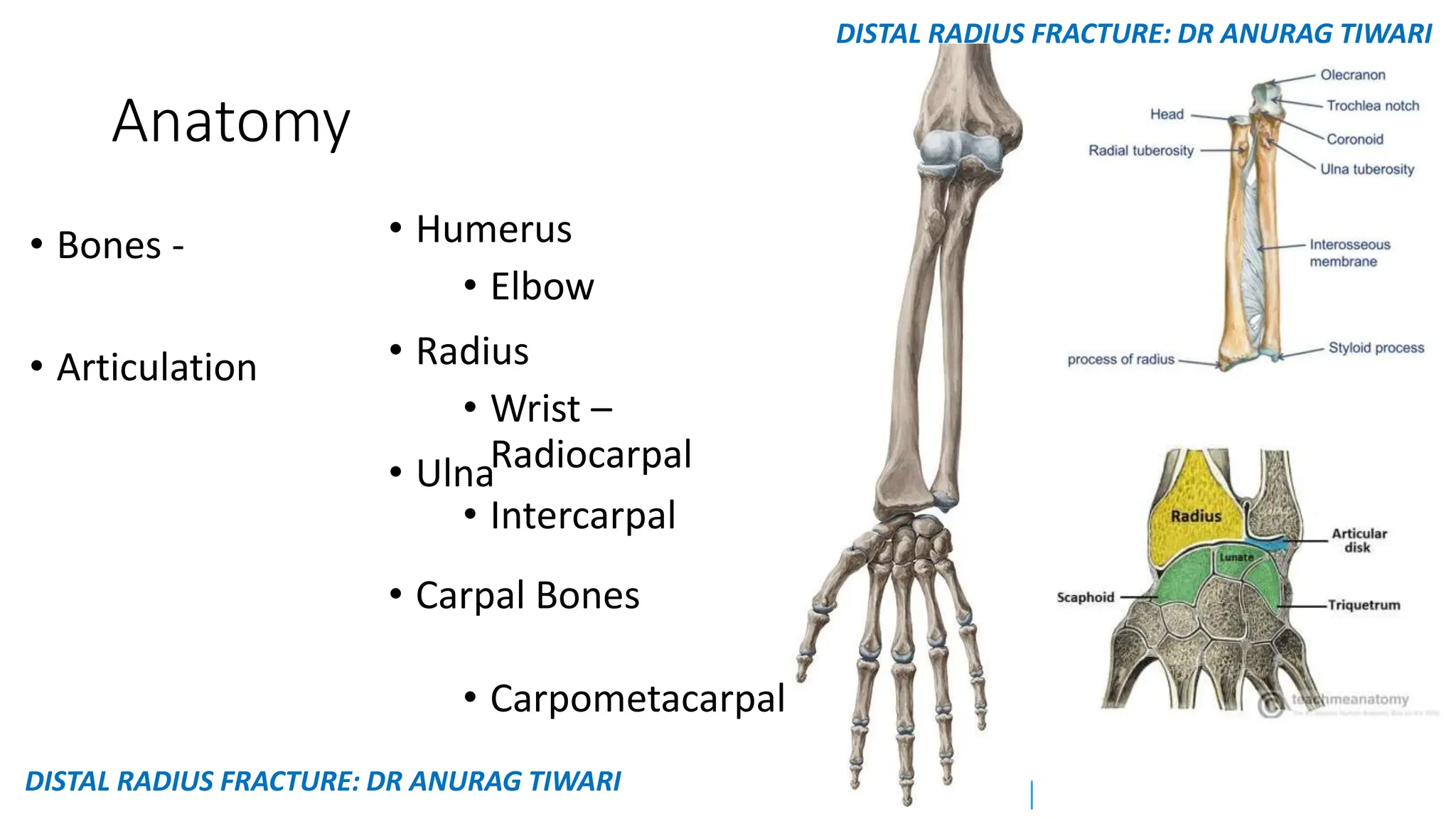 Distal radius #UG .pptx