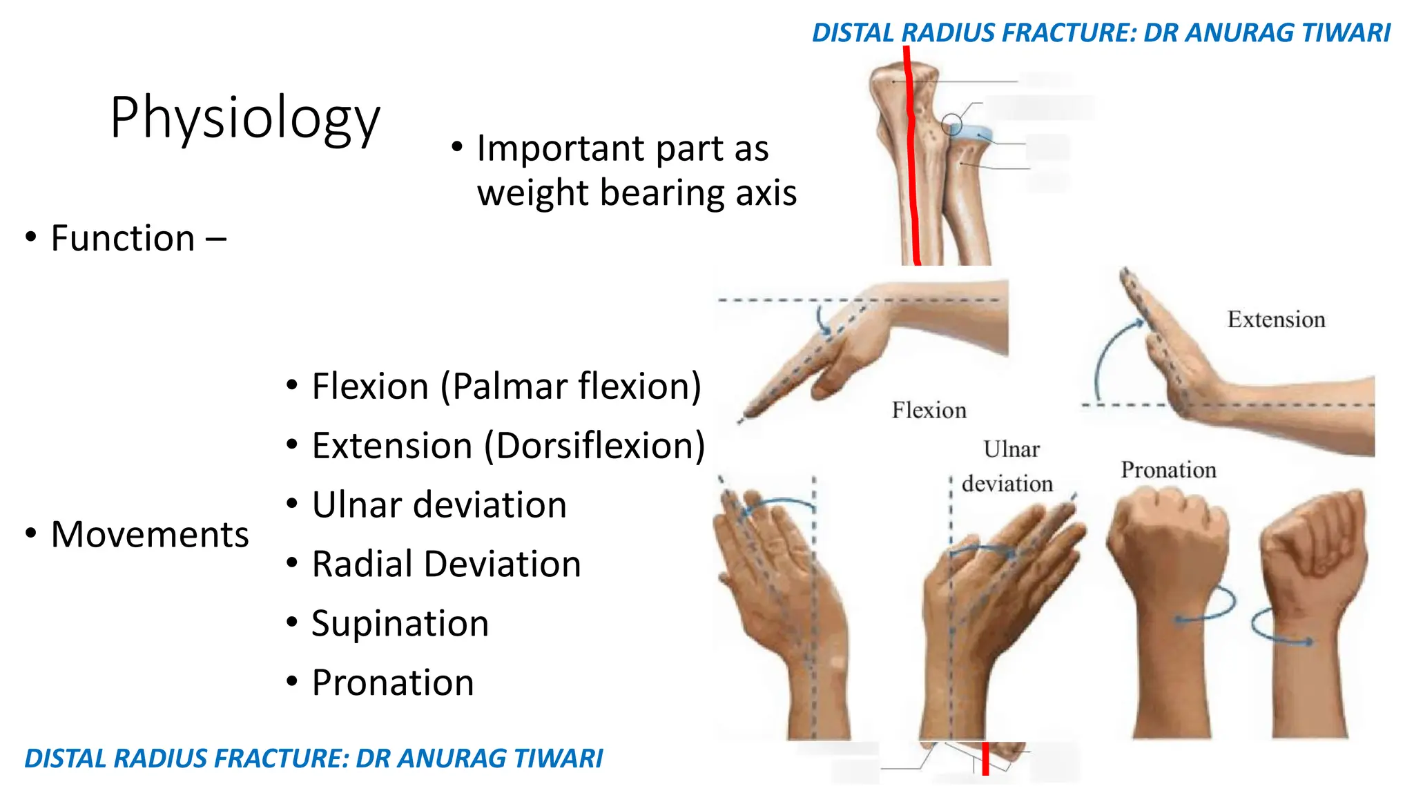 Distal radius #UG .pptx