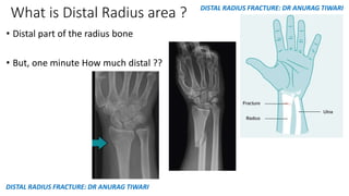 Distal radius #UG .pptx | Death, Injury, or Military Conflict ...