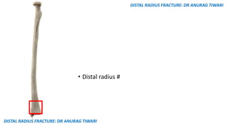 Distal radius #UG .pptx