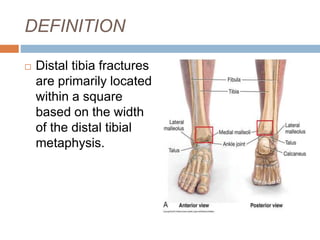 Distal Tibia Fracture Classification