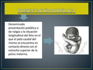 DISTOCIAS DE PARTO TRANSVERSA Y OBLICUA DEL FETO Y PRESENTACIÓN ...