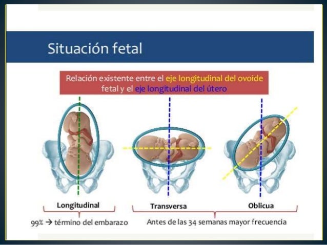 DISTOCIAS DE PARTO TRANSVERSA Y OBLICUA DEL FETO Y PRESENTACIÓN PODÁL…
