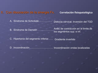 Distocia de la contraccion uterina durante trabajo de parto | PPT