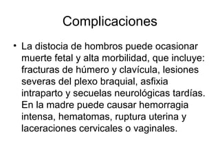 Distocia de hombro | PPT