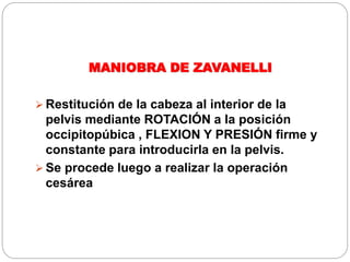 DISTOCIA DE HOMBROS202 obstetricia 3.ppt