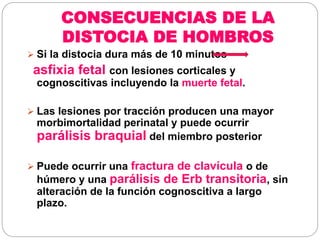 DISTOCIA DE HOMBROS202 obstetricia 3.ppt