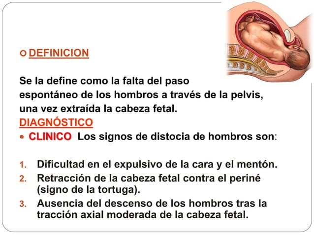 DISTOCIA DE HOMBROS202 obstetricia 3.ppt | Pregnancy | Reproductive Health