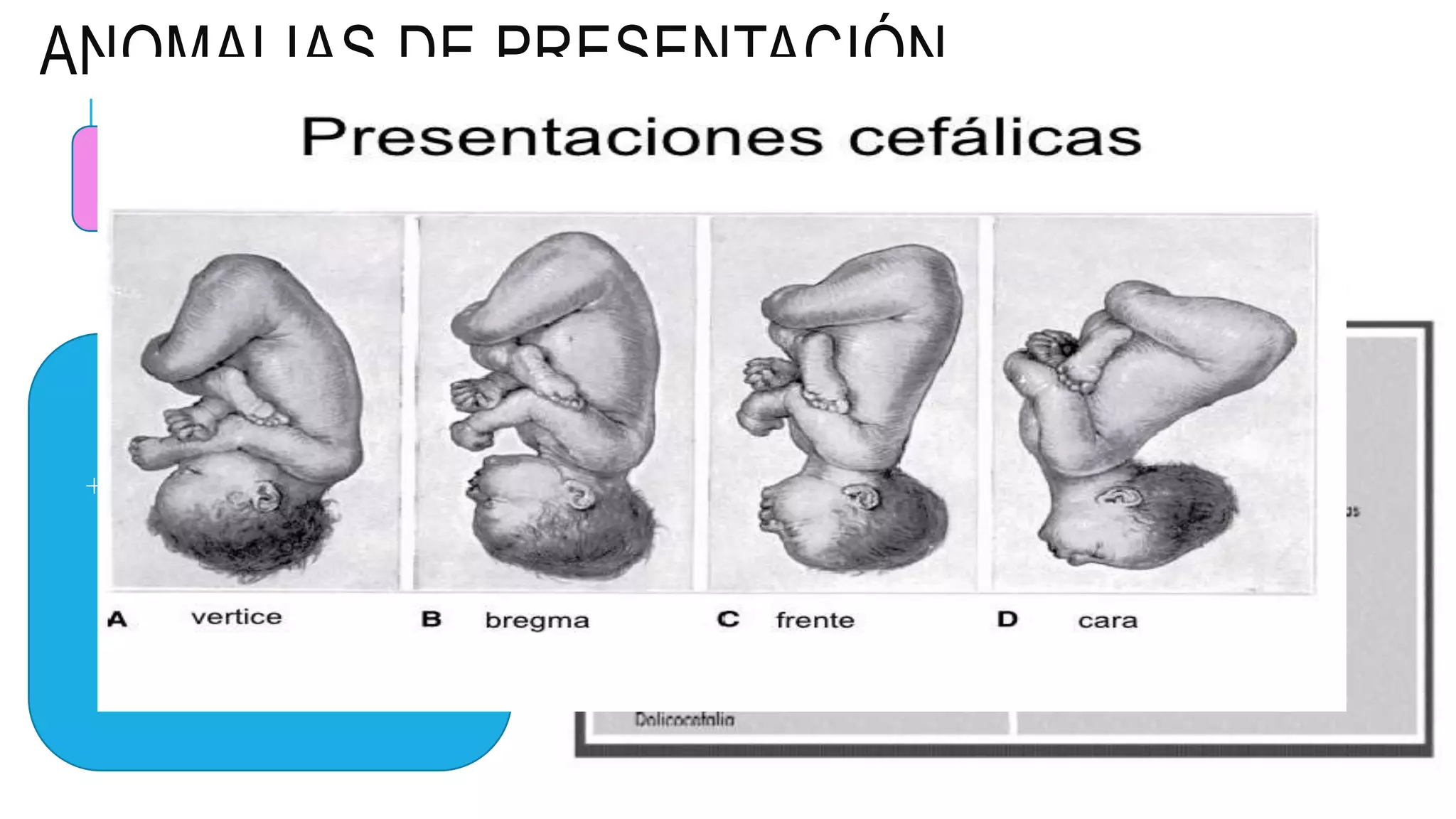 Distocia fetal | PPT