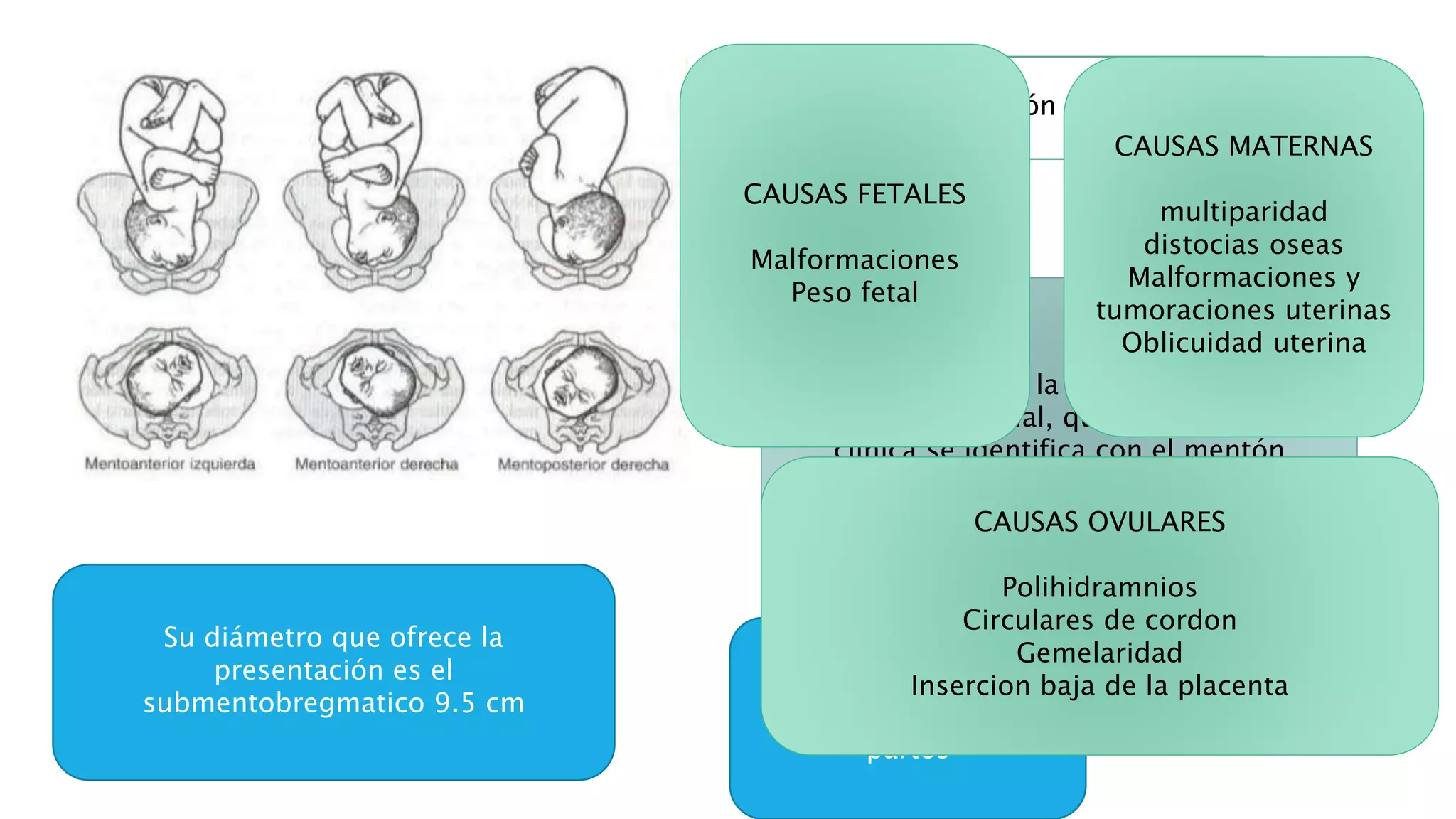 Distocia fetal | PPT